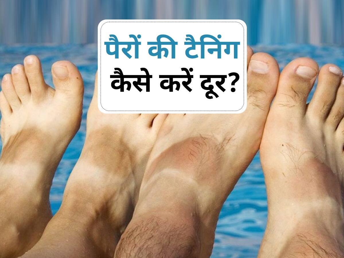 Remove Sun Tanning from Feet : तेज धूप की वजह से पैरों का रंग हो गया है ...