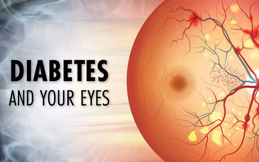 7 Unusual Symptoms of Diabetes In Eyes: Here's How A Diabetic Eye Looks ...