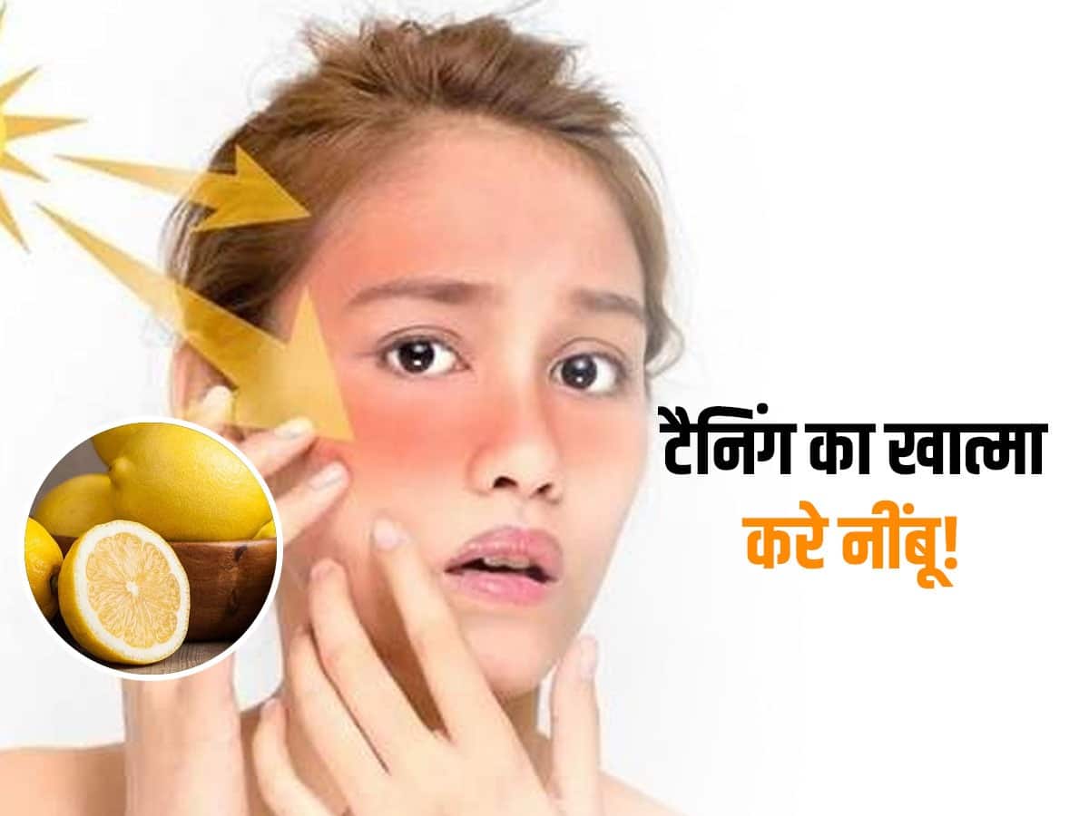 Removing Tan with Lemon Juice : गर्मियों में नंबू से सन टैन का करें ...