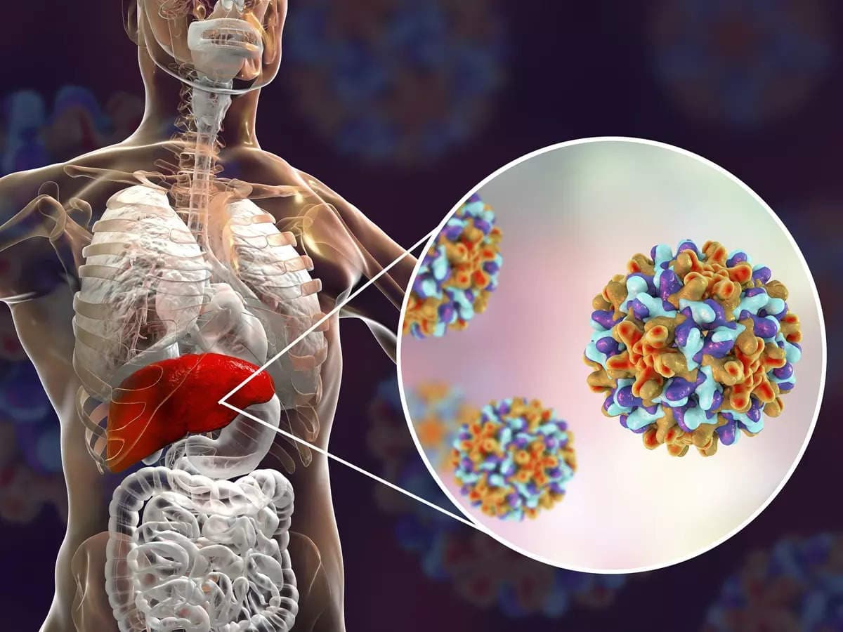 Liver Cancer Symptoms: 5 Warning Signs of Hepatocellular Carcinoma That ...