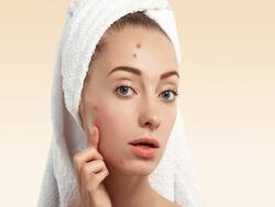 Pimples : Top and Latest News, Articles, Videos and Photo About Pimples