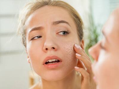 A Robust Skin Barrier Is Crucial For Optimal Sensitive Skin Health: 6 ...