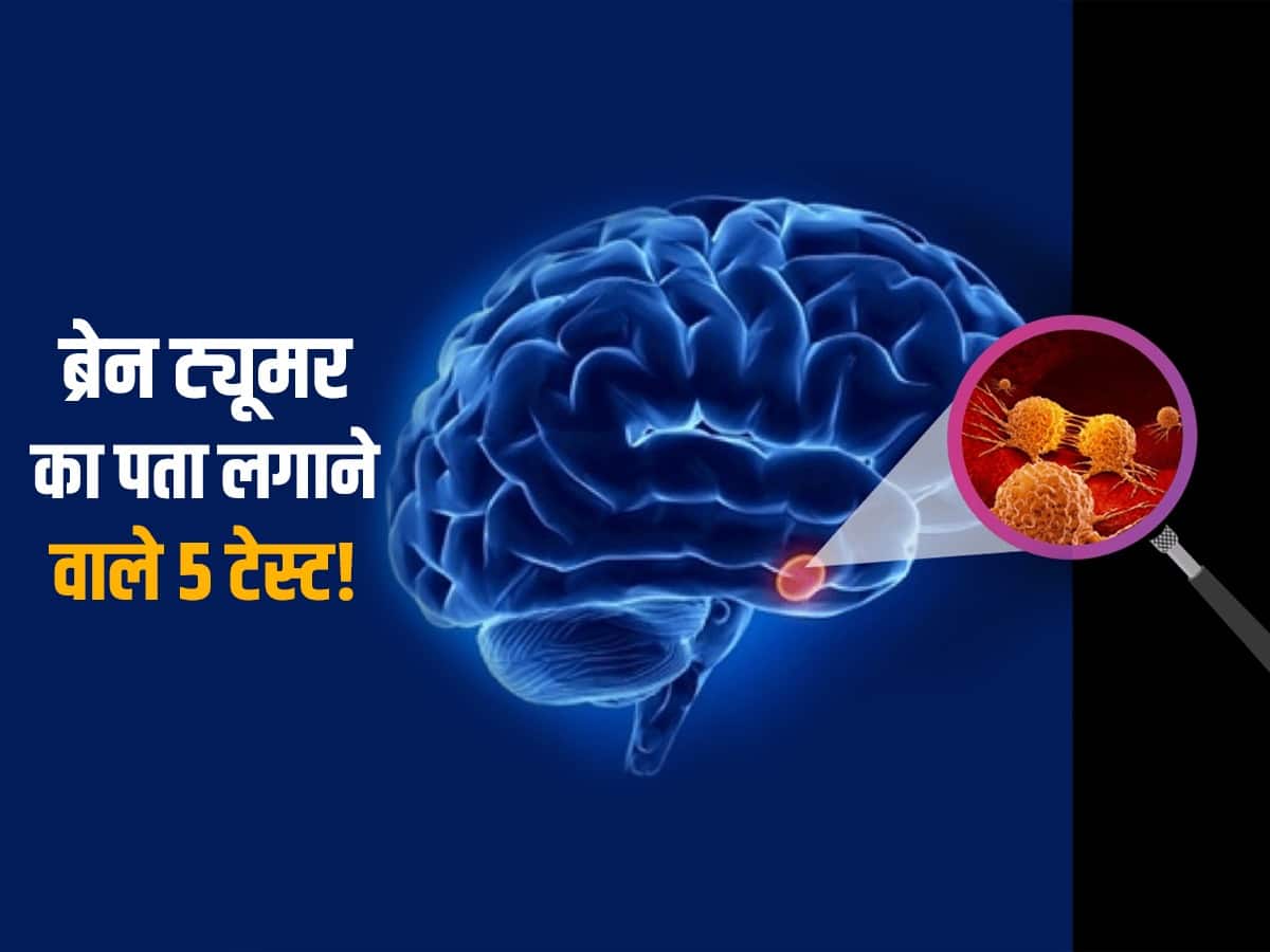 Brain Tumor tests : ब्रेन ट्यूमर का पता लगाने में मदद करेंगे ये 5 टेस्ट ...
