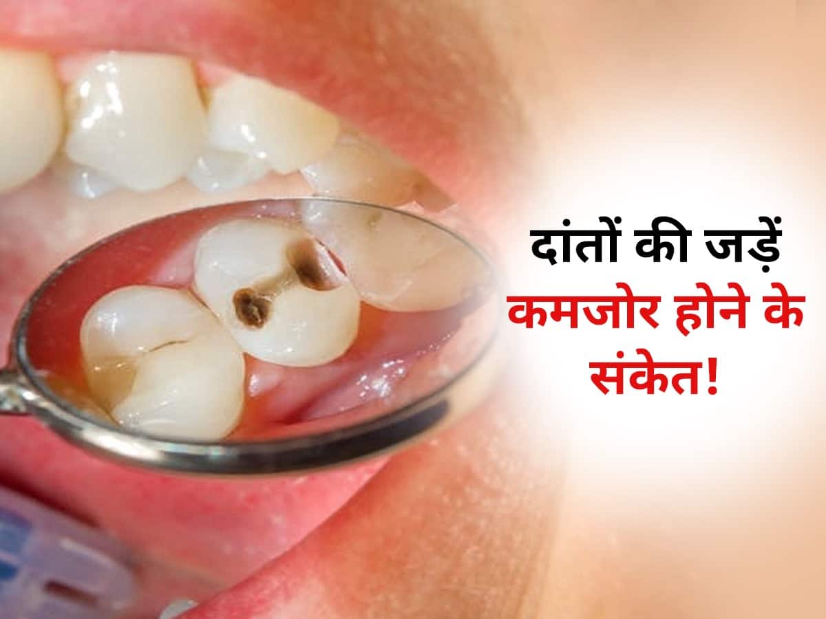 Tooth Resorption : दांतों की जड़ें खराब होने पर दिखते हैं ये लक्षण ...