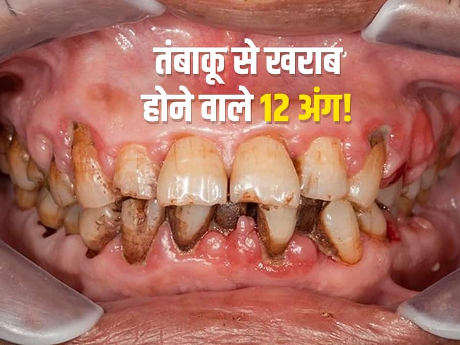 Tobacco Side effects : सिर्फ मुंह ही नहीं तंबाकू से खराब होते हैं शरीर ...