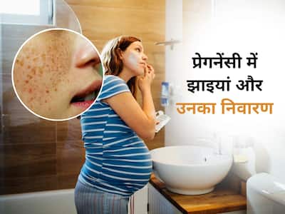 Skin care: प्रेगनेंसी के बाद चेहरे की झाइयां जाने का नाम ही नहीं ले रही ...