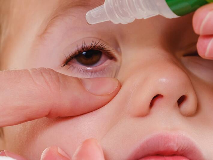 Conjunctivitis Cases On The Rise In Delhi: Symptoms, Causes And ...