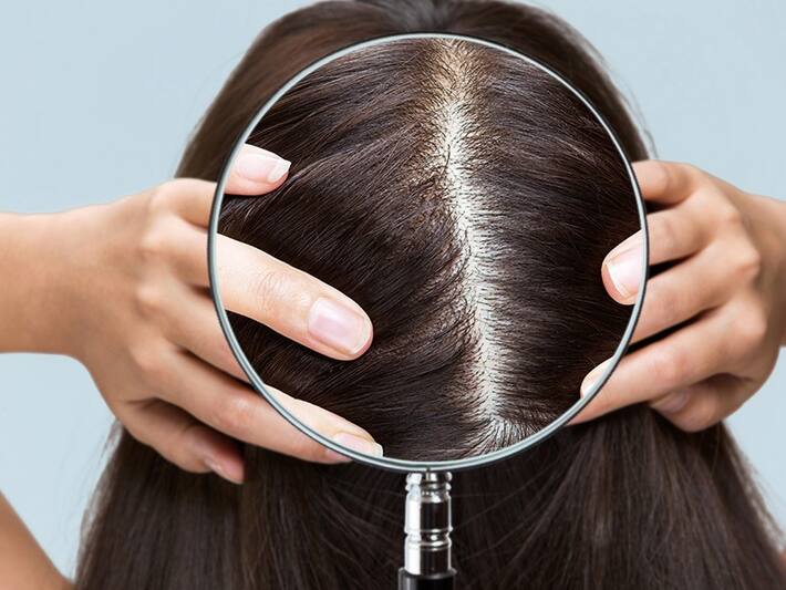 Hair Care Tips: Know 5 Possible Causes Of Hair Fall And Their Solutions ...