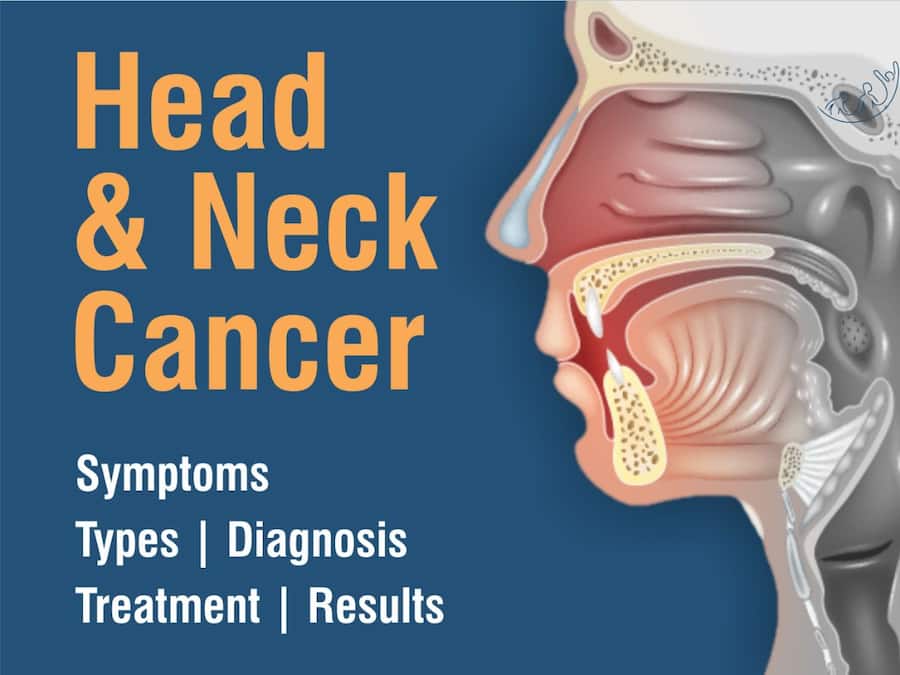 Head And Neck Cancer Symptoms: 7 Warning Signs of Head Neck Cancer You ...