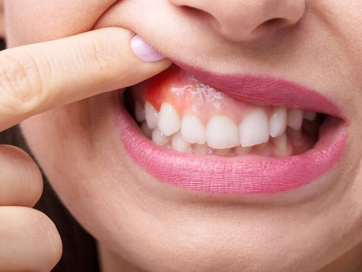 Oral Health: Understanding The Significance Of Gum Colour ...