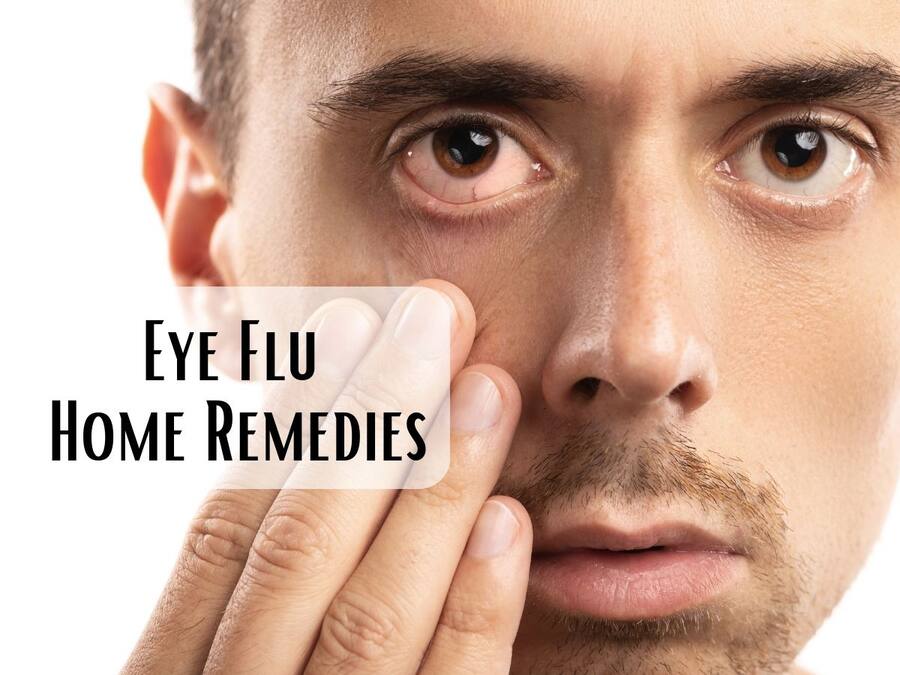 Eye Flu Home Remedies: How To Deal With Conjunctivitis or Pink Eye ...