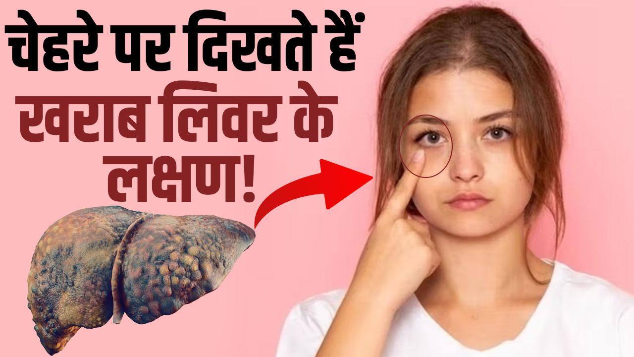 Liver Disease Symptoms Liver खराब होने पर चेहरे पर दिखते हैं ये लक्षण देखें ये Video