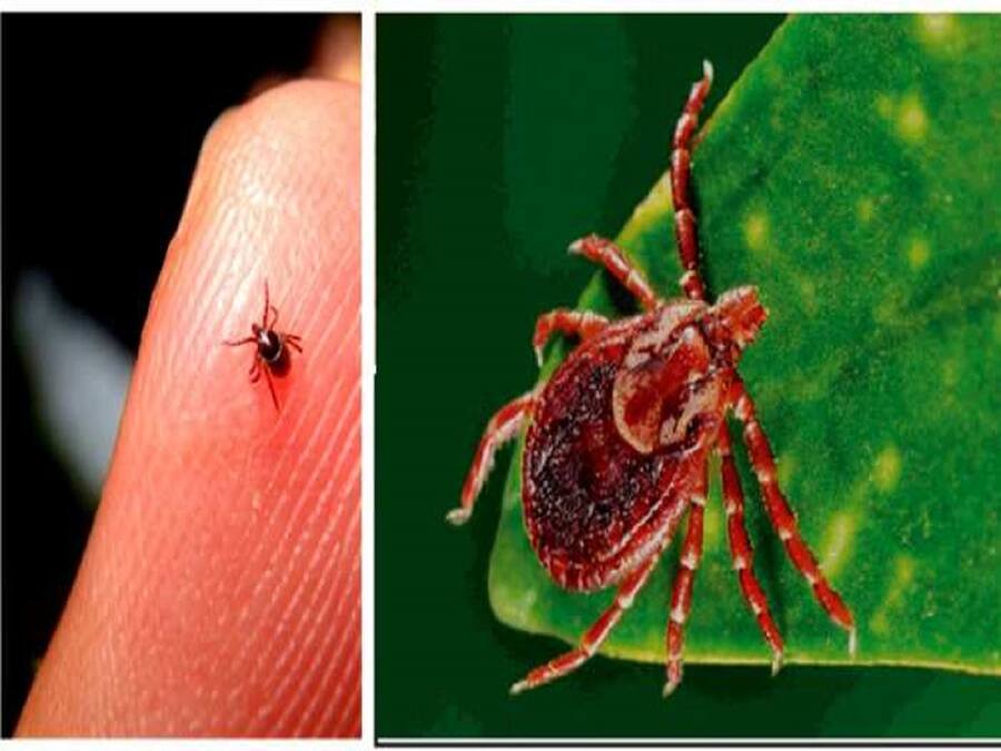 Scrub Typhus Claiming Lives In Shimla: Be Aware Of The Signs And ...