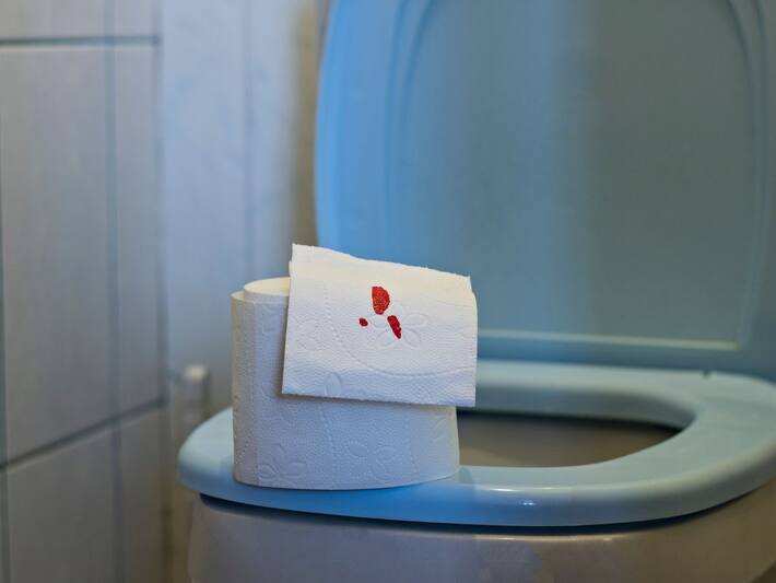 Dark Coloured Urine and 5 Other Toilet Symptoms That Could Be Signs of ...