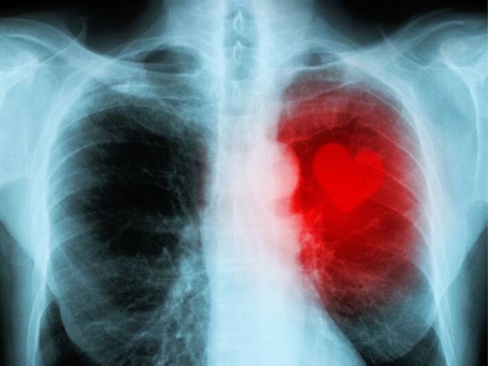 Heart Attack Protection Tips: 7 Essential Tests to Check Your Heart ...