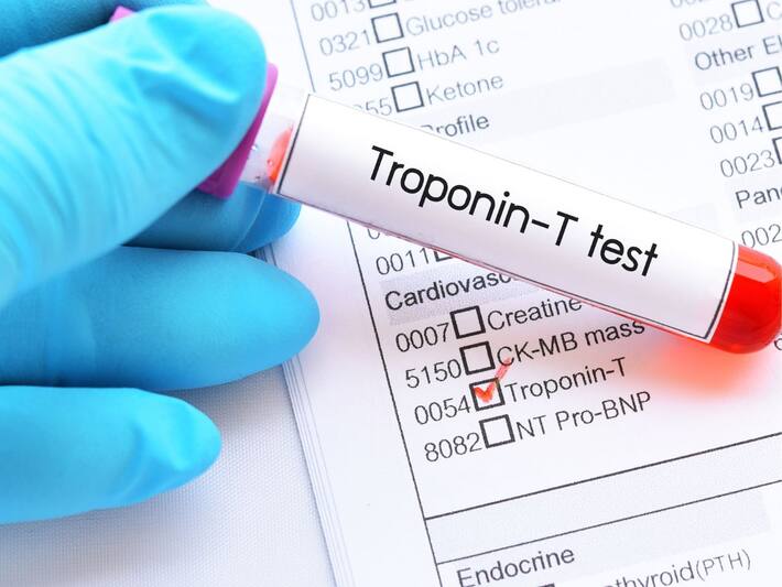 Heart Attack Protection Tips: 7 Essential Tests to Check Your Heart ...