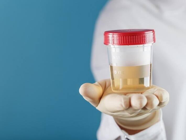 Symptoms Of High Uric Acid In Urine | पेशाब में दिख रहे इन बदलावों से ...