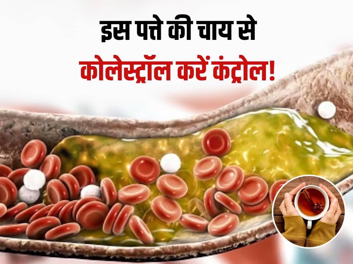 Jamun Leaf Tea for Cholesterol : सिर्फ 1 सप्ताह तक पिएं इस पत्ते की चाय ...