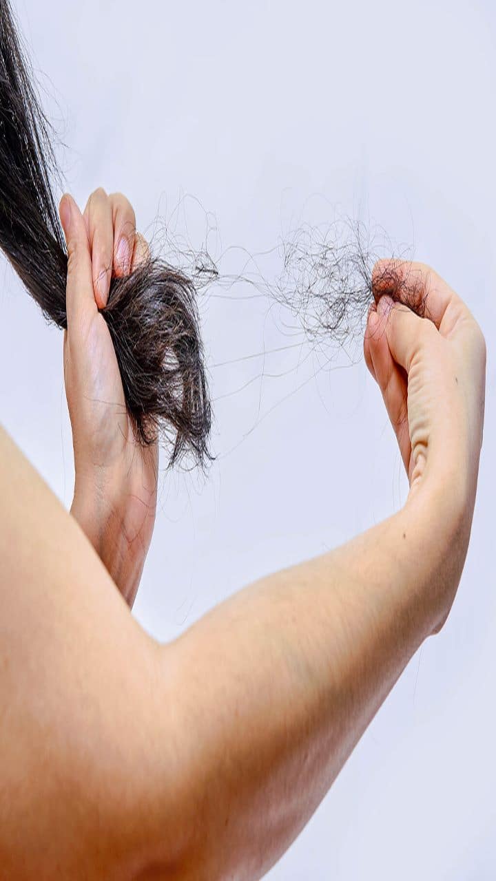 Say No To Hair fall By Adding These 7 Foods In Your Diet