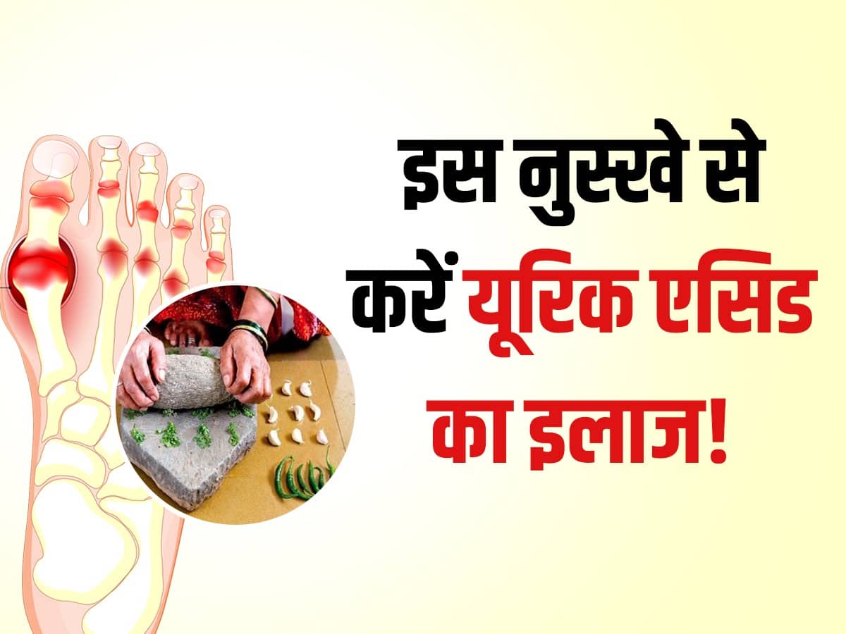 Uric Acid Home Remedies यूरिक एसिड क्रिस्टल को चूर चूर कर निकाल सकता है ये नुस्खा दर्द और
