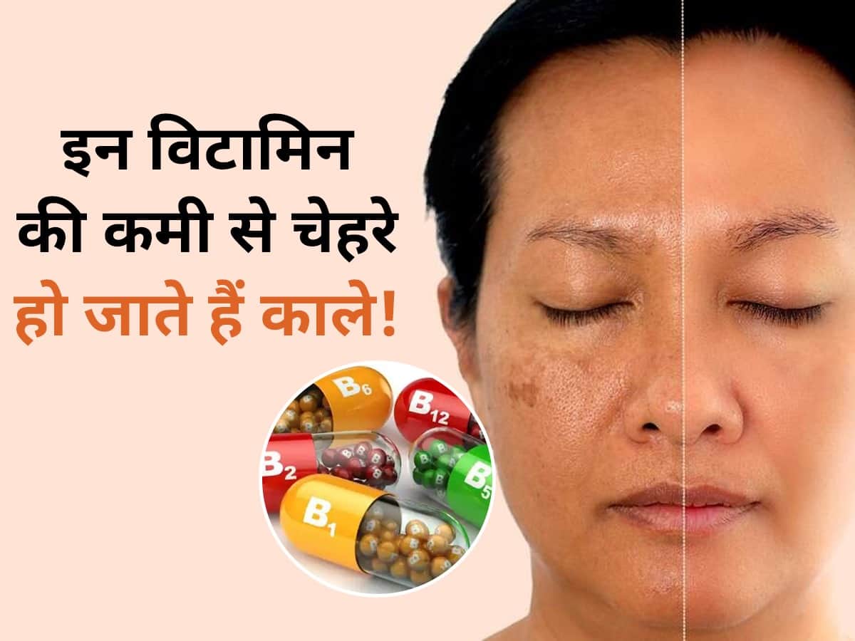 Kis Vitamin Ki Kami se Skin Kali Hoti hai | शरीर में इन 2 विटामिन की ...