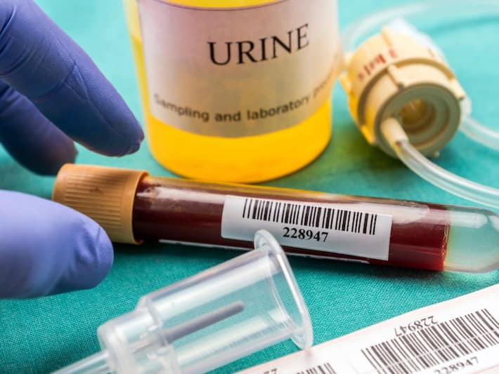 Liver Damage Symptoms: Don't Ignore These 5 Signs Of Liver Damage In ...