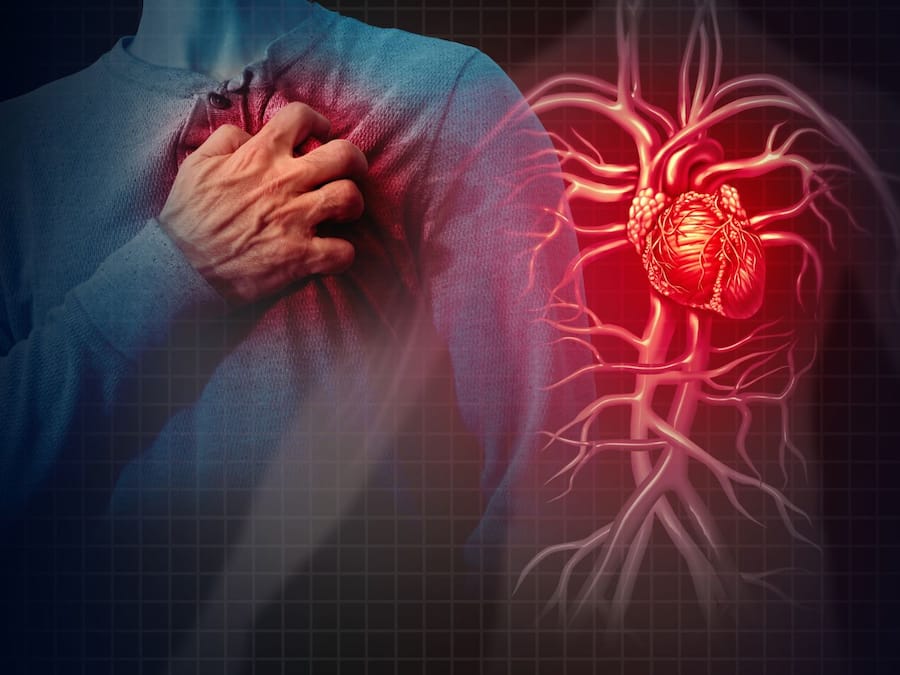 Different Types of Heart Attacks: How to Recognize the Signs and Symptoms of Heart Attack ...
