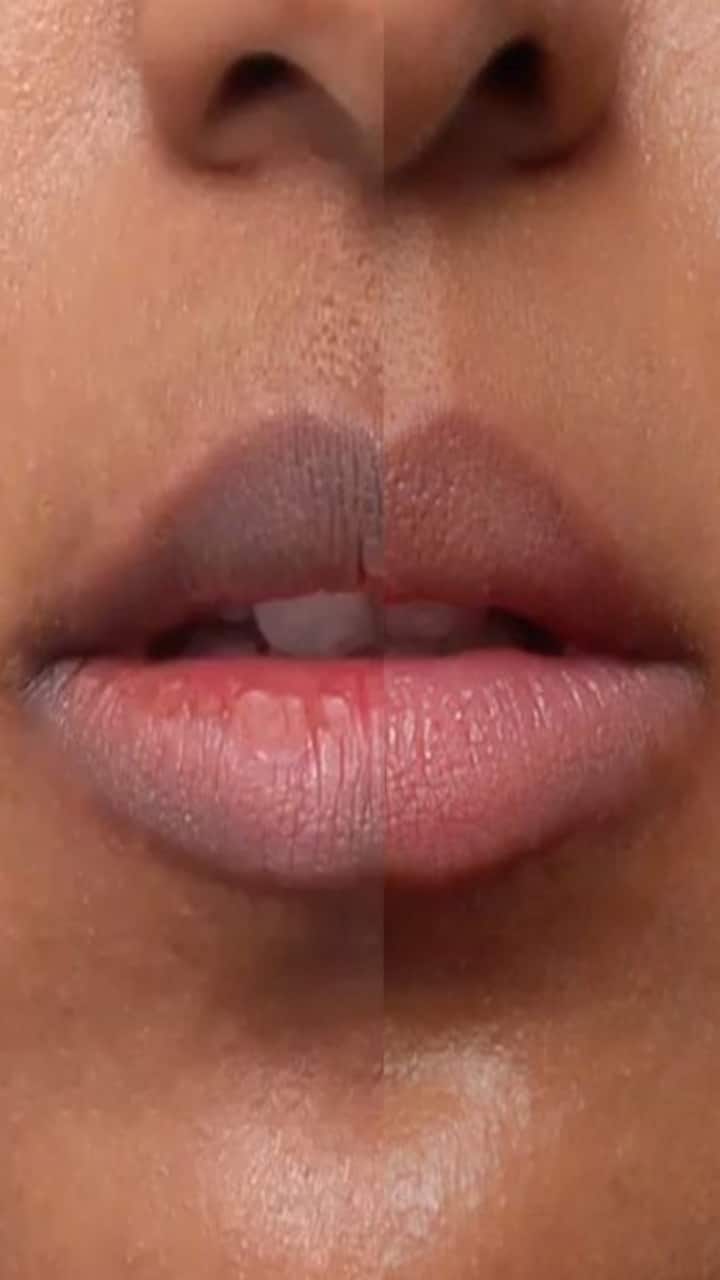 Steer Clear of These 8 Habits That Can Harm Your Lips