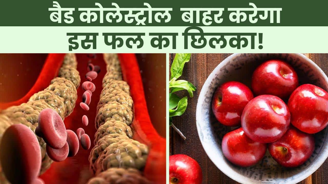 Bad Cholesterol को बाहर करेगा ये इस फल का छिलका! Watch Video | TheHealthSite.com हिंदी