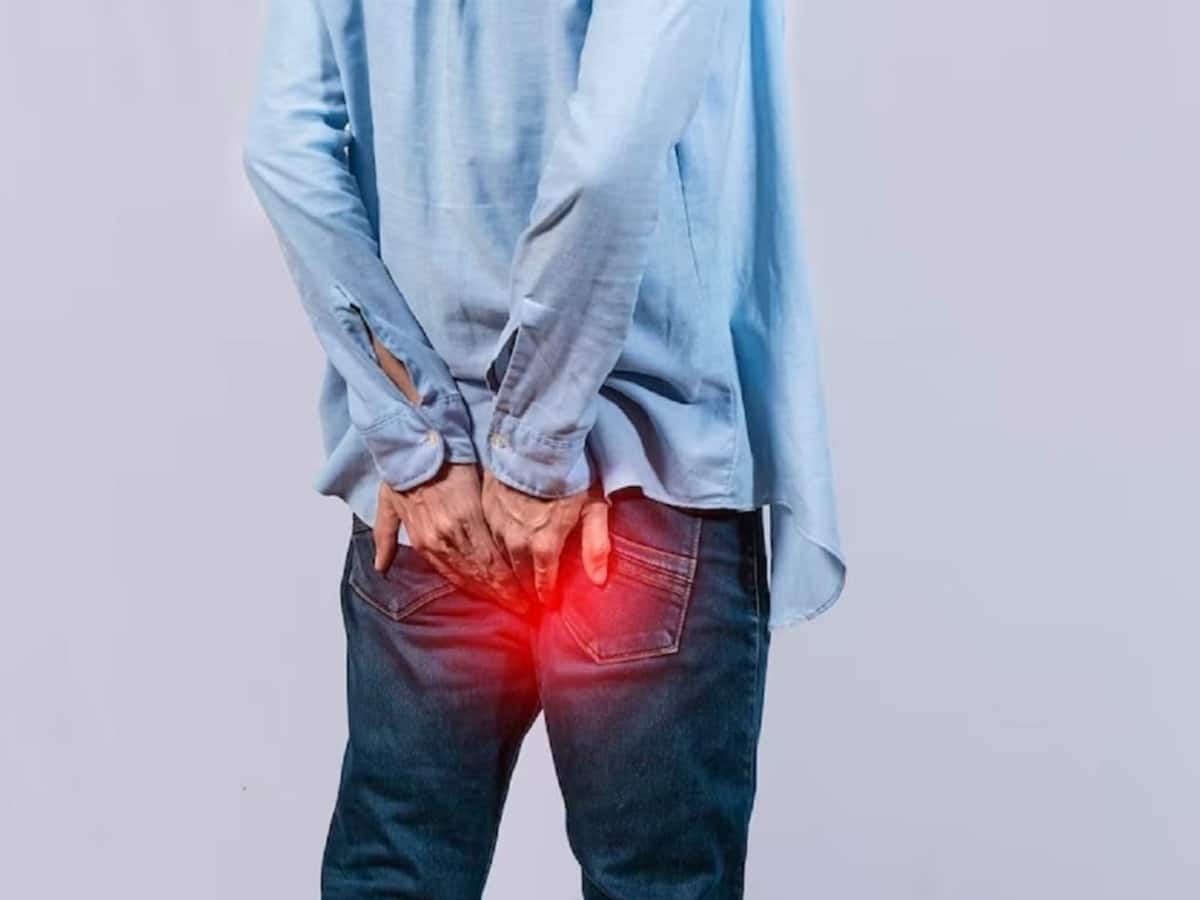 Pilonidal Sinuses Treatment: Understanding EPSiT For The Management Of ...