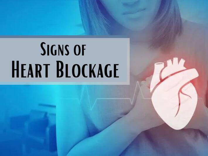 Signs of Heart Blockage: 7 Unexpected Symptoms That Could Indicate ...