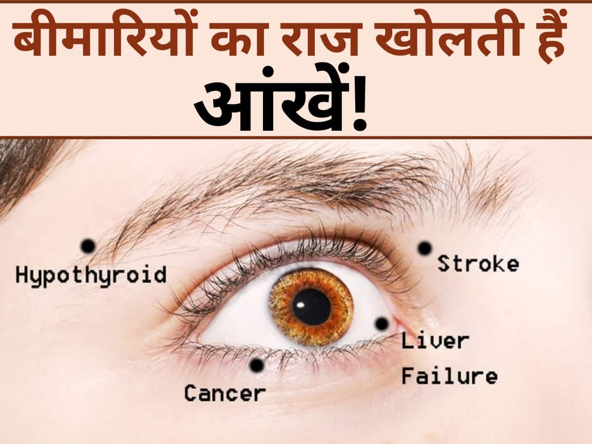 आंखों के आसपास इन 5 बदलावों से समझ जाएं गंभीर बीमारियों की चपेट में आ ...