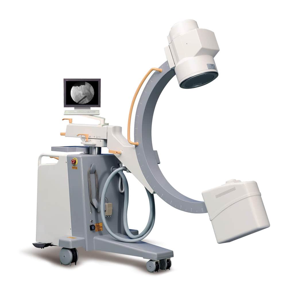Digital C-ARM Technology: How Has Medical Imaging Revolutionized By ...