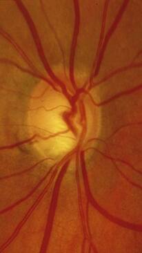 Diseases & Conditions Web Stories - Learn Beginner to Advanced