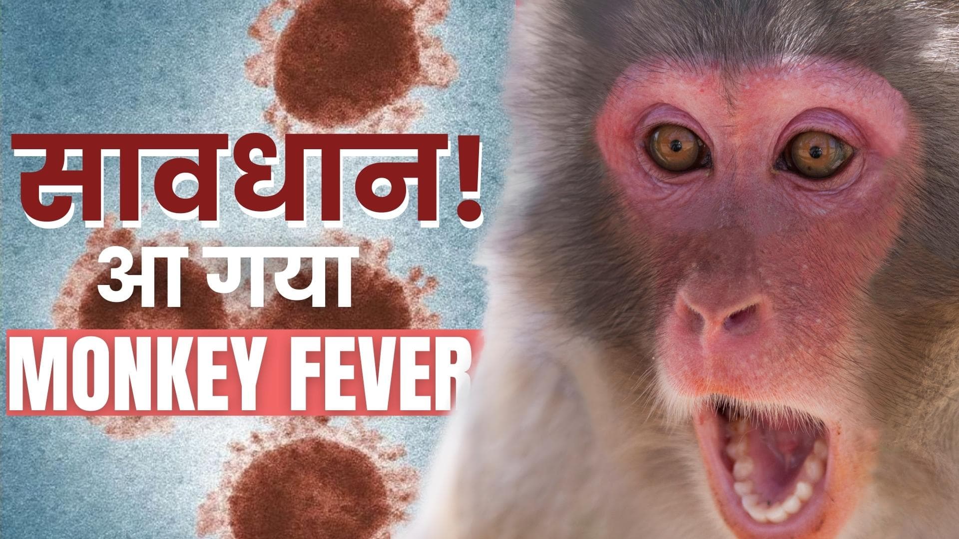 Monkey Fever Symptoms: Karnataka में बढ़ रहे हैं मंक फवर के मामले ...