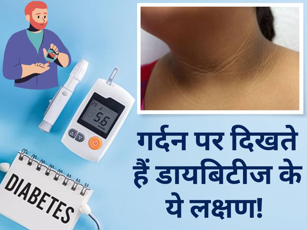 गर्दन के आसपास इन संकेतों से समझ जाएं हद से ज्यादा बढ़ चुका है ब्लड ...