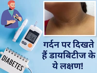 गर्दन के आसपास इन संकेतों से समझ जाएं हद से ज्यादा बढ़ चुका है ब्लड ...