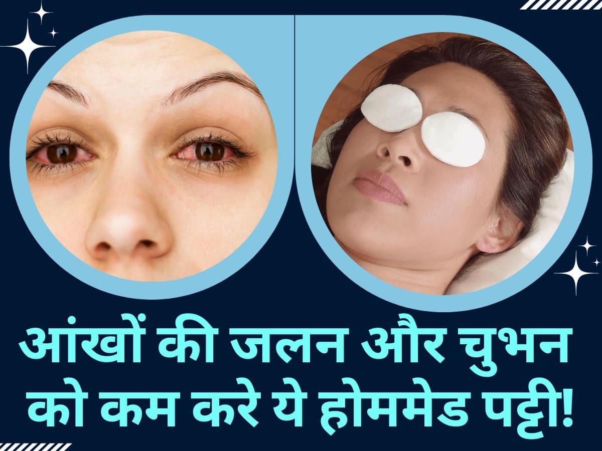 आंखों में जलन और चुभन कम करे ये चमत्कारी पट्टी, घर पर इन आसान तरीके से ...