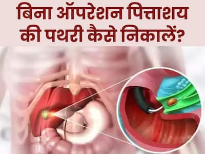 pitt ki thaili ki pathri ka gharelu upay | पित्त की थैली में पथरी होने ...