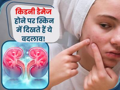 किडनी डैमेज होने से पहले स्किन पर दिखते हैं ये 5 लक्षण, इग्नोर करना पड़ ...