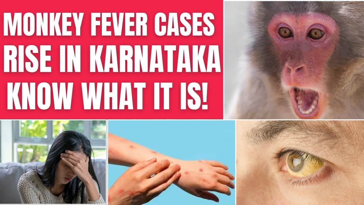 Monkey Fever: Karnataka on Alert: Symptoms You Should Be Aware Of ...