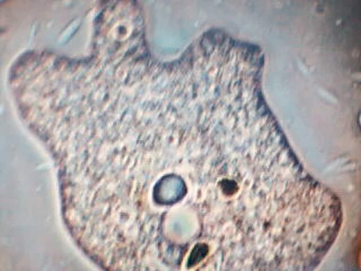 Warning: Nasal Rinses With Tap Water Can Give You Deadly Amoeba ...