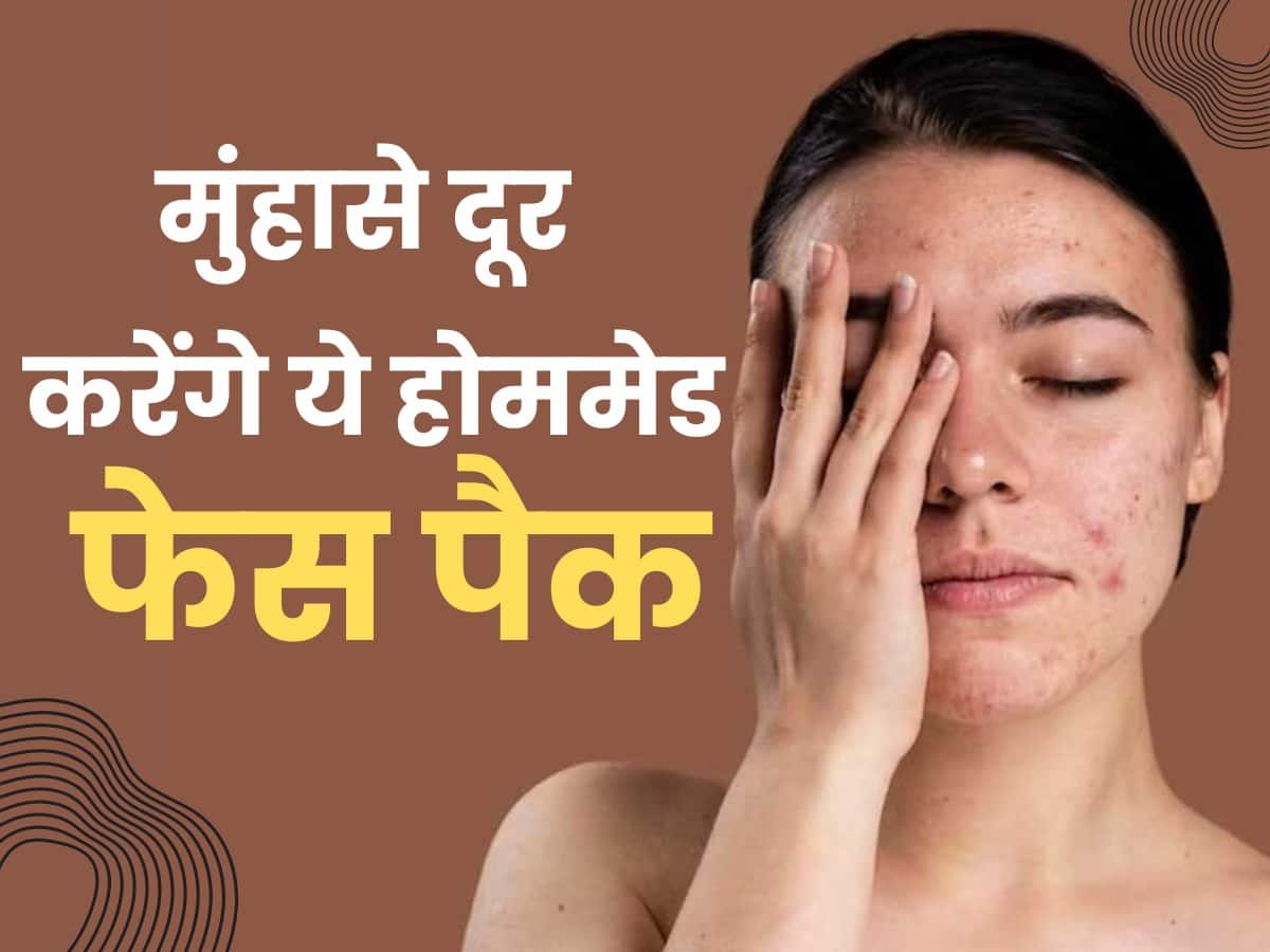 Pimples Ke Liye Face Pack | पिंपल्स और एक्ने से छुटकारा पाने के लिए ...