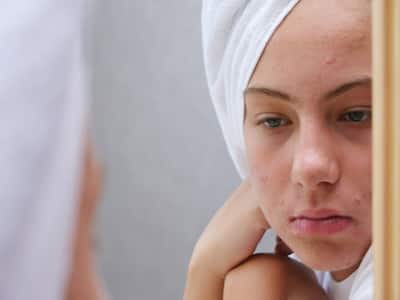 5 Simple Ways You Can Help Your Teenager Fight Acne Flare-Ups ...