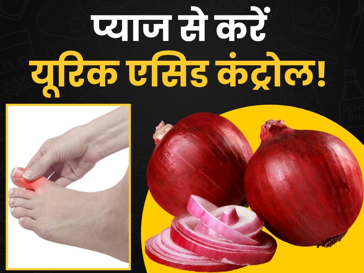 बढ़े हुए यूरिक एसिड को कम करने में असरदार है प्याज, बस इस तरह करें ...