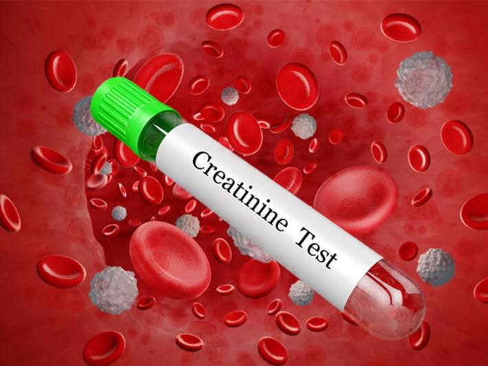 खून में क्रिएटिनिन बढ़ना किडनी के लिए है खतरे की घंटी, इन 5 फलों के ...