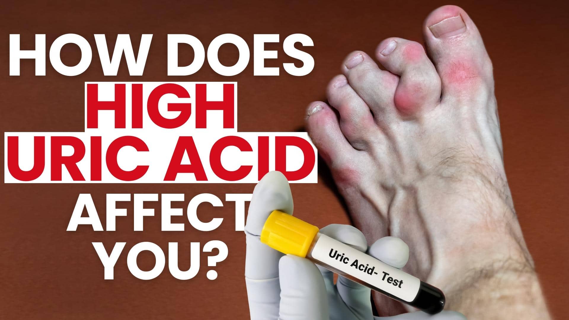 Yoga Asanas To Lower High Uric Acid Levels Naturally | TheHealthSite.com