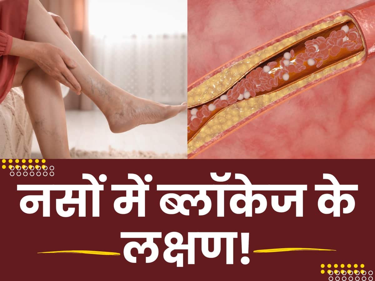 Nas Block Hone Ke Lakshan | शरीर में दिख रहे हैं ये लक्षण तो समझ जाएं ...