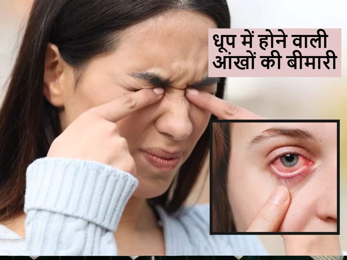 बढ़ती गर्मी के साथ ही बढ़ रहा है आंखों की बीमारियों का खतरा, Eye ...