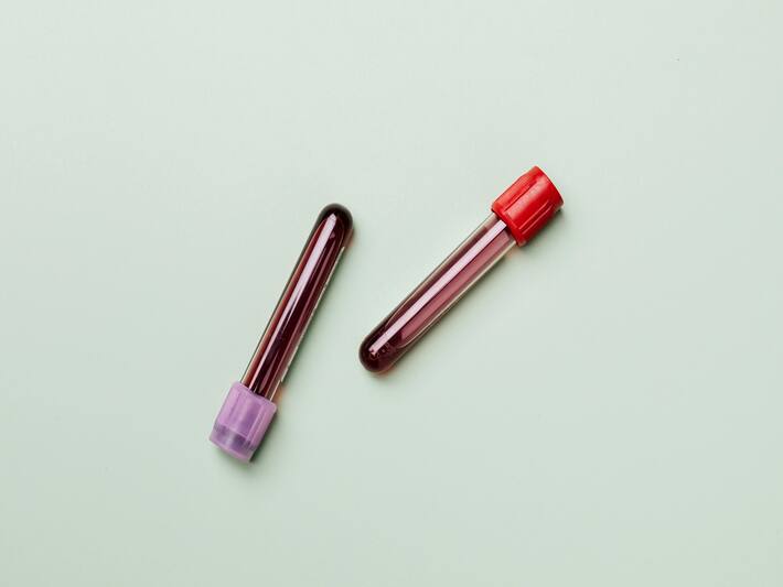 Important Blood Tests For Overall Health: How Often Should You Get ...